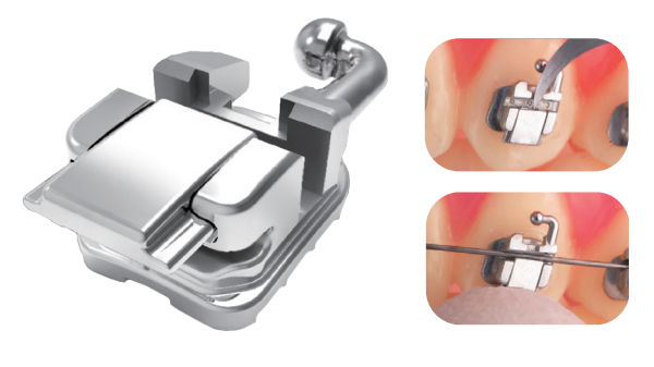 Brackets Nu-Edge Self-Ligating - Cecsmo